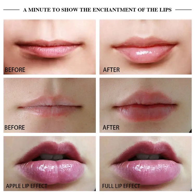Buy Wholesale China Lip Plumper Electric Extreme Lip Plumper Machine ...