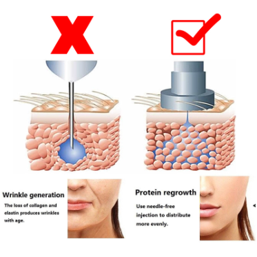 Wholesale Lip Hyaluronic Acid Pen Needle Free Hyaluronic Pen Fat ...