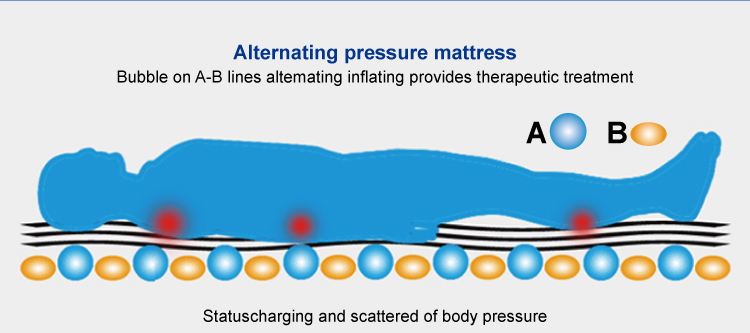 Medical Alternating Pressure Mattress And Hospital Bed Mattress ...