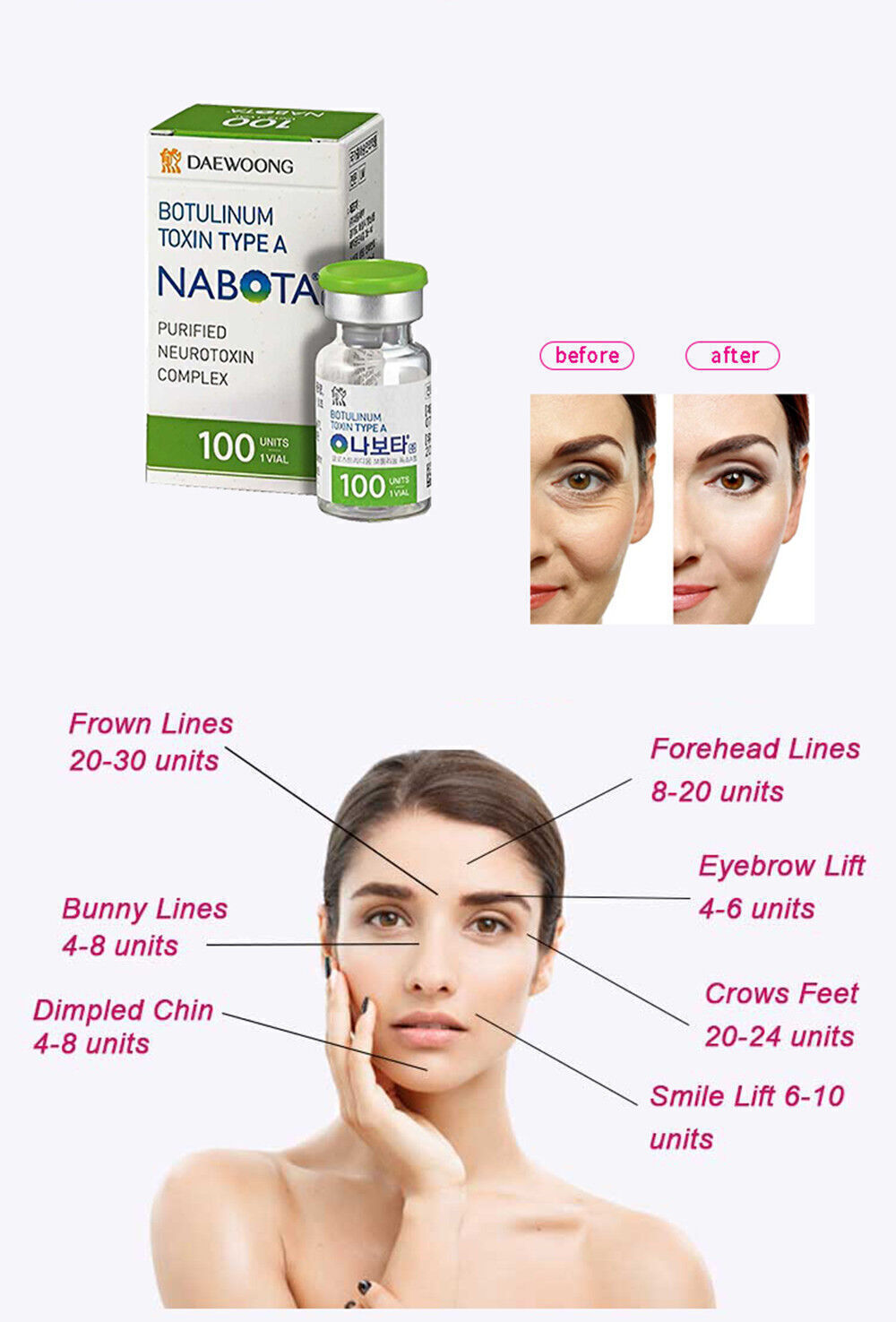 Buy Wholesale China 2023 Korea Original 100units Bo-tox Na-bota ...