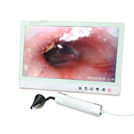 Lhgk03 Digital Ent Ear Camera Endoscope Otolaryngology Examination ...