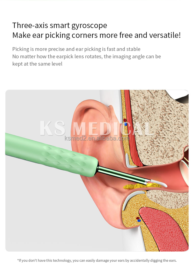 Buy Wholesale China Ksmed Top Selling Visual Ear Otoscope Ksm-veo High ...