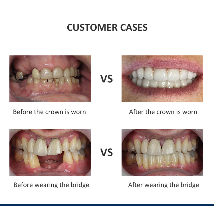 Buy Wholesale China Manufacturer Supply Cad Cam Dental Price Pink Peek ...