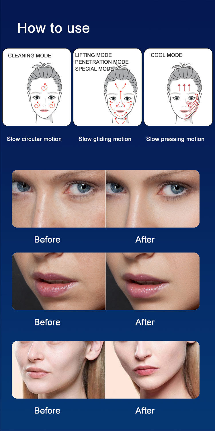 Buy Wholesale China 2024 Newest Facial Beauty Device Rf Ems Functions ...
