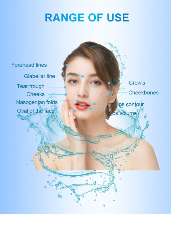 Buy Wholesale China Radiesses Dermals Fillers 1.5cc Used For Facial ...