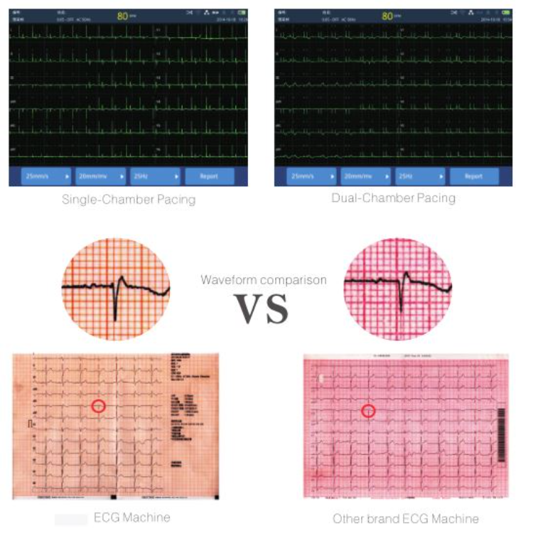 Bulk Buy China Wholesale High Quality Portable Ecg Electrode Production ...