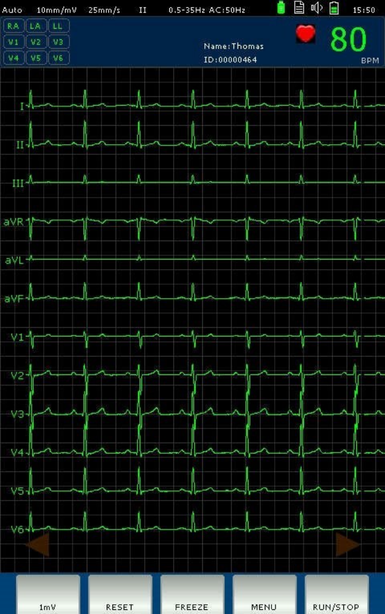 Dawei Best Sales High Sensitive Vet Portable 3 Channel Ecg Ekg ...