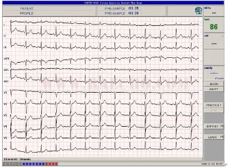Buy Wholesale China Rse-8000s Professional Stress Ecg System 12 Leads ...