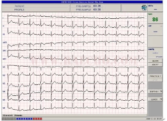 Buy Wholesale China Rse-8000s Professional Stress Ecg System 12 Leads ...