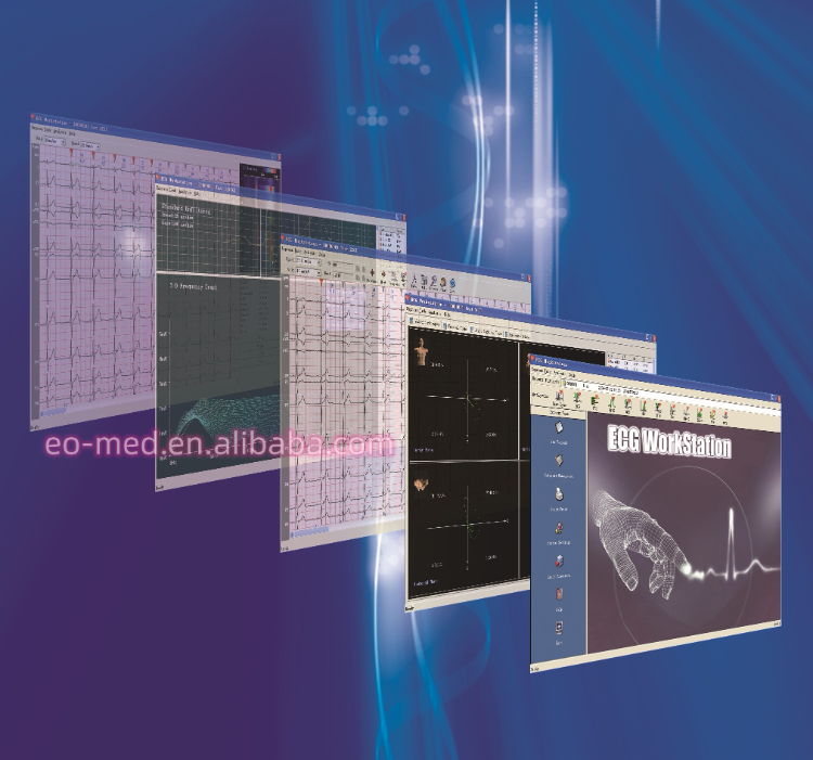 Buy China Wholesale W-8000g Price Cheap Top Precision Ecg Workstation ...