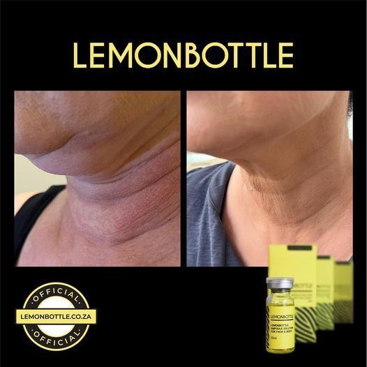Buy Wholesale China Lemon Bottle Fat Dissolving Non-surgical Fat ...