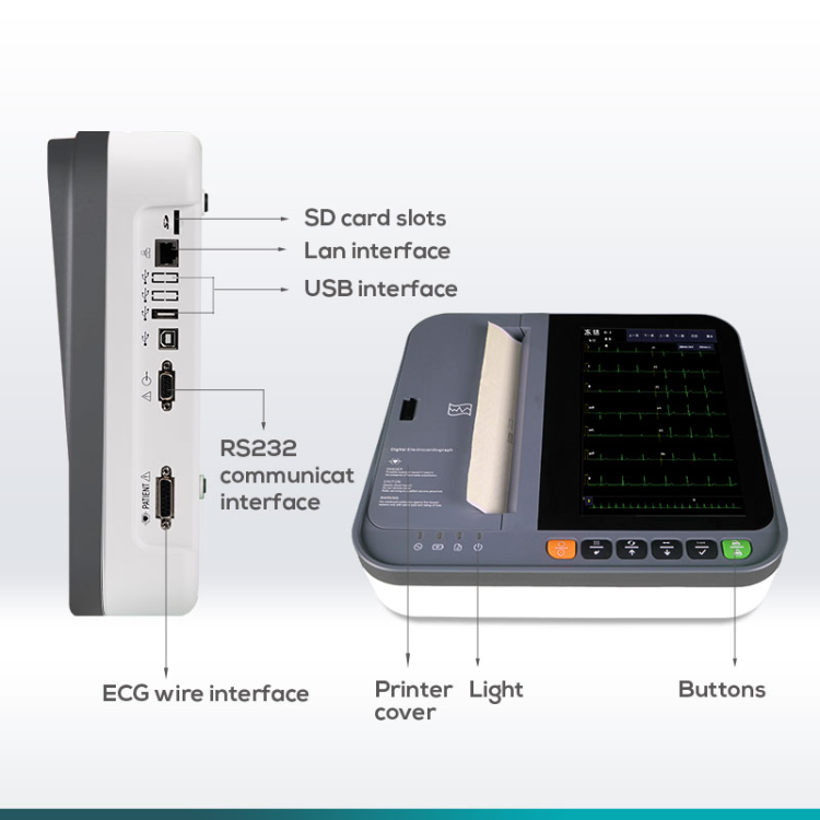 Dawei 12 Lead Ekg 12 Channel Ecg Machine - Explore China Wholesale Ekg ...