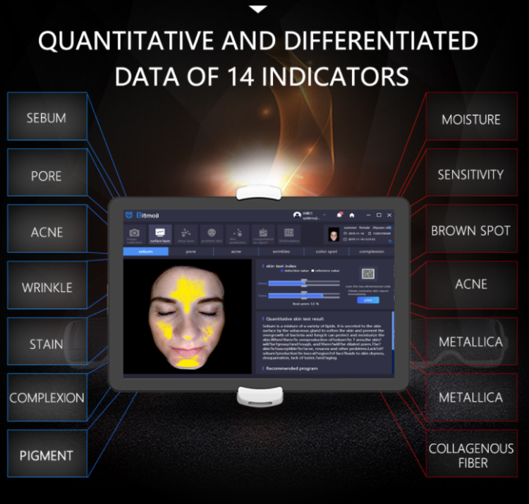 Buy Wholesale China Skin Analyzer Machine Facial Analyser Visia Skin ...