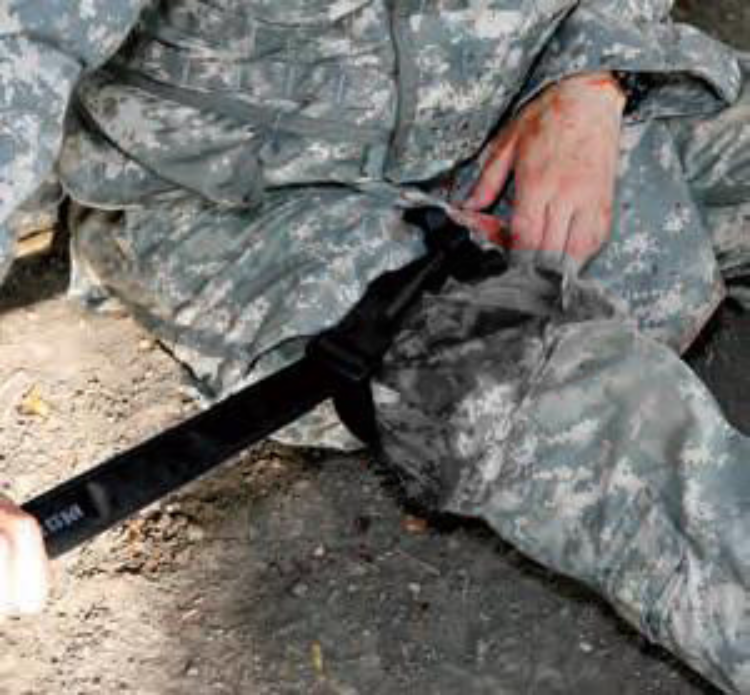 Buy Wholesale China Fast And Effective Hemostasis High-quality Sof Tourniquet & Sof Application ...