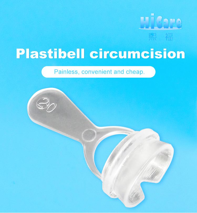 Buy Wholesale China China Medical Genital Plastic Stapler Circumcision ...