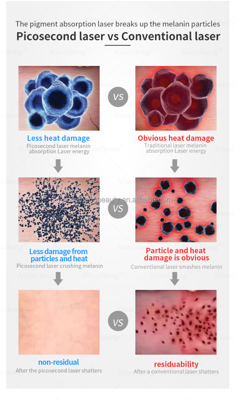 Buy Wholesale China Picosecond Tattoo Removal Machine 1064 Nm 755nm ...