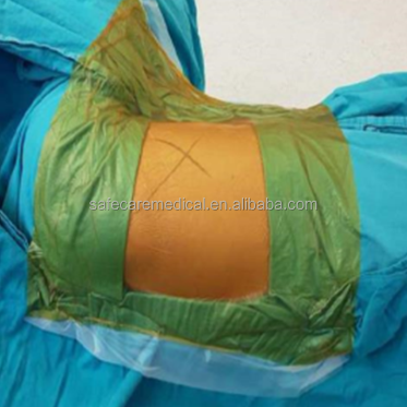 Disposable Medical Incise Iodine Machine Ioban Antimicrobial Surgical ...