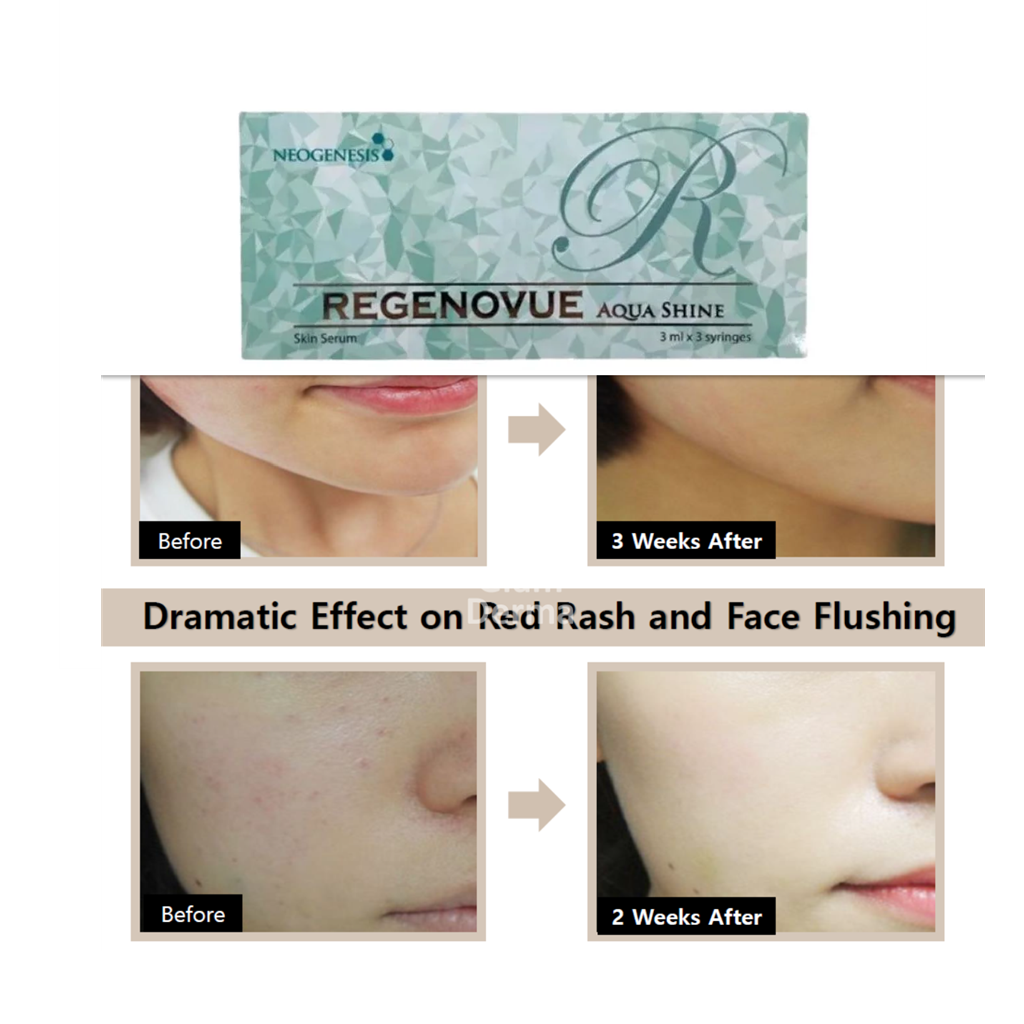 Buy Wholesale China Regenovue Aqua Shine Plus: Instant Skin ...