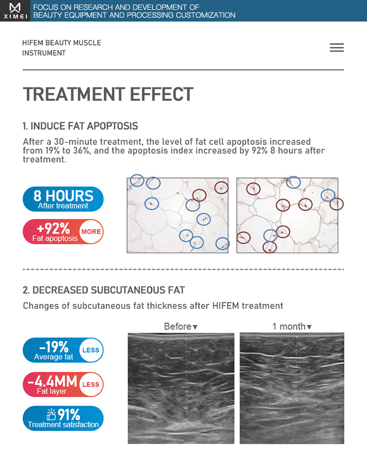 Buy Wholesale China The New 2 In 1 High Intensity Electromagnetic ...