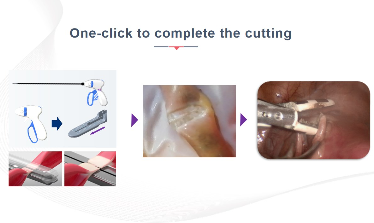 Buy China Wholesale Manufacturers Wholesale Erbe-bisect Laparoscope ...