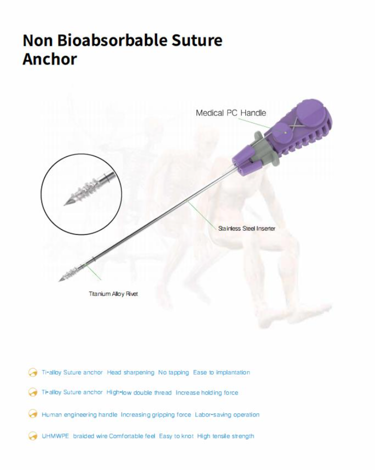 Well Trust Suture Anchor With Nonabsorbable Surgical Suture Titanium ...