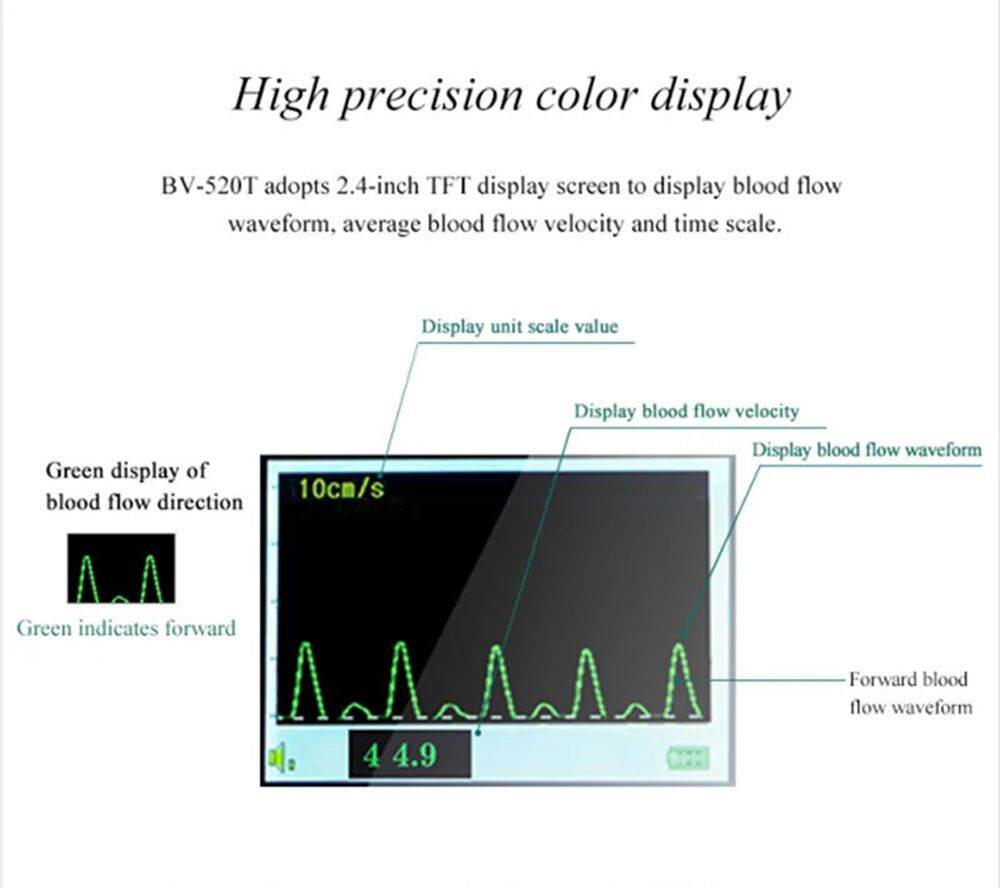 Vascular Blood Detector, Portable Blood Flow Detector With 8 Mhz Flat ...