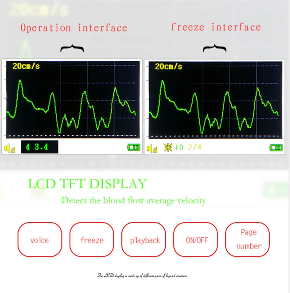 Vascular Blood Detector, Portable Blood Flow Detector With 8 Mhz Flat ...