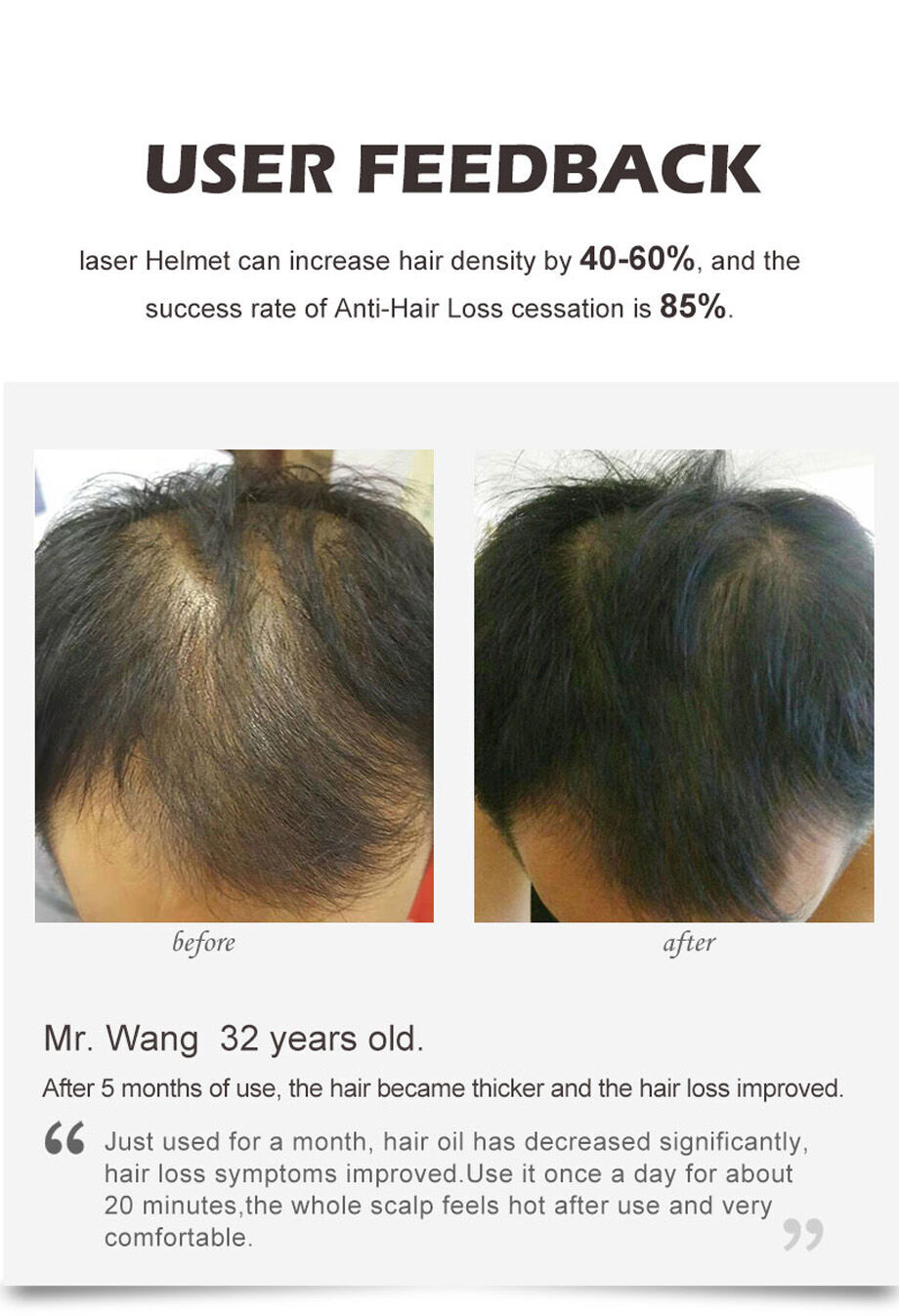 Buy Wholesale China Esthetician Device Laser Cap Hair Treatment Hair ...