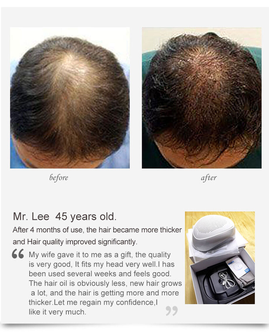 Buy Wholesale China High Quality 650nm Hair Restoration Clinic Cool Red ...