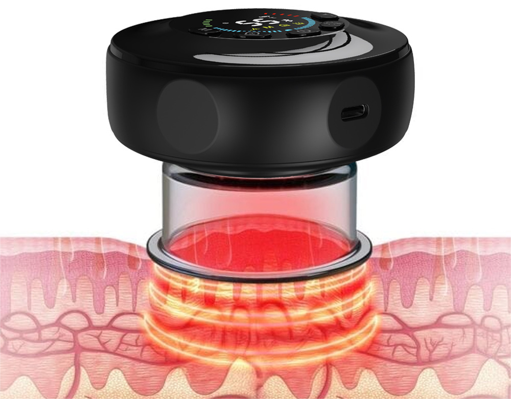 Smart Massage Therapy Cupping Sets Chinese Vacuum Cupping Machine ...