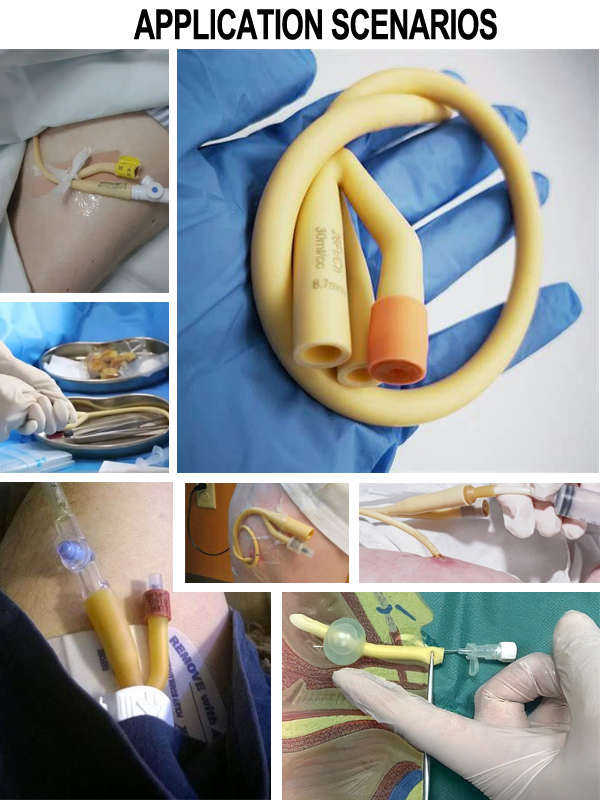 Buy Wholesale China Disposable Medical Latex Catheter Foley 2 Way ...