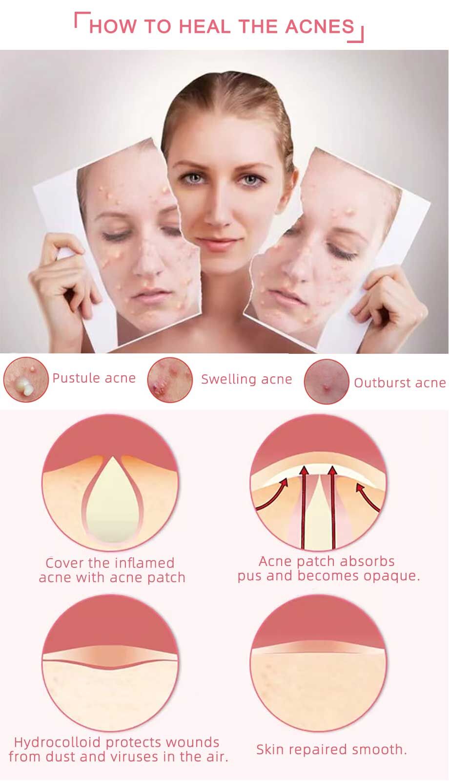 Custom Waterproof Invisible Hydrocolloid Acne Pimple Spot Patch ...