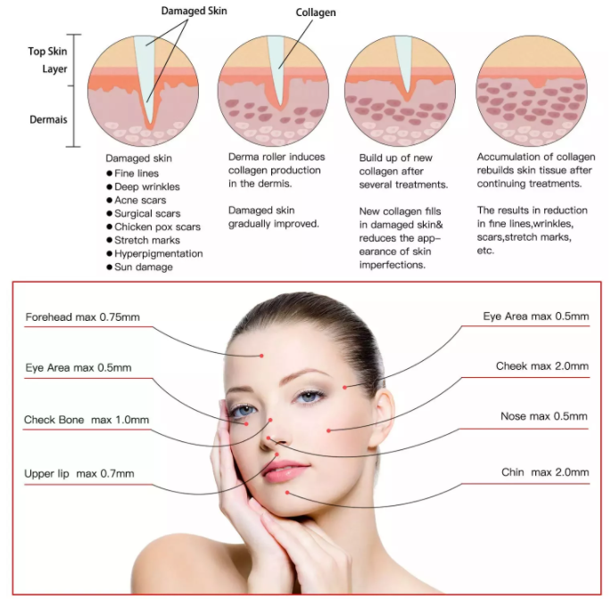 Buy Wholesale China Derma Pen A1 Needle Derma Pen Microneedle Cartridge ...