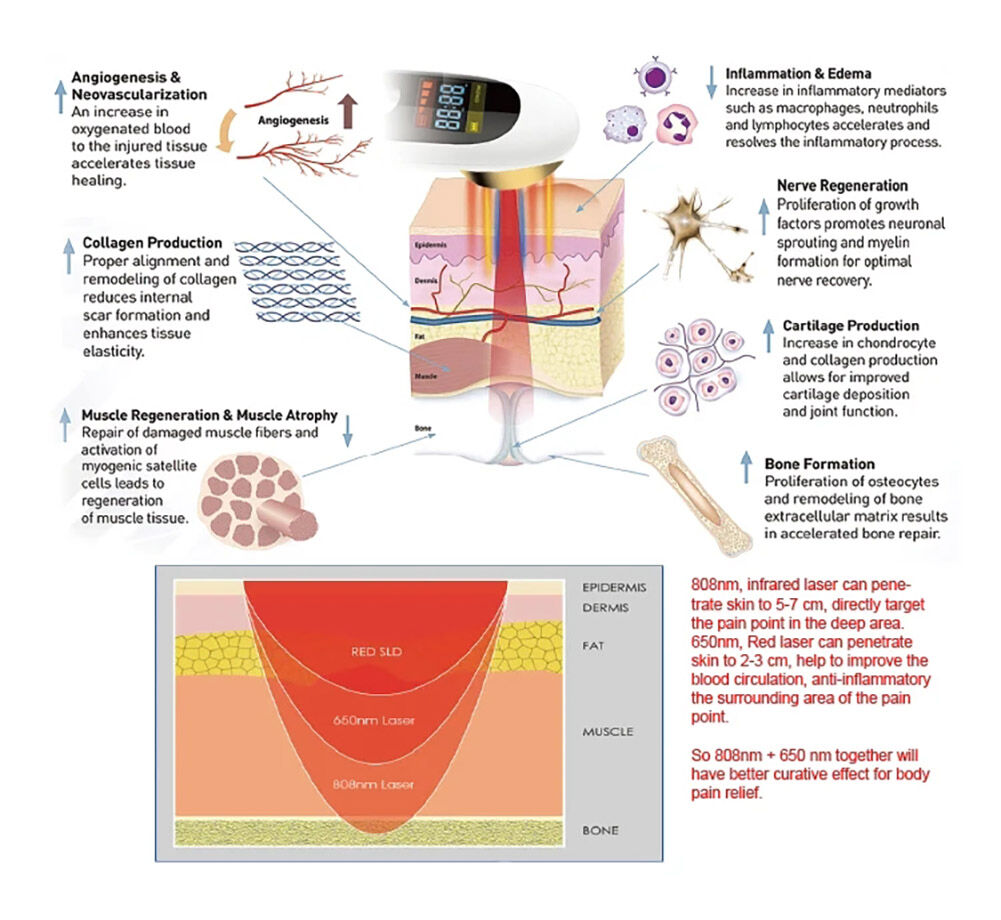 Factory Direct High Quality China Wholesale Veterinary Class 3r Laser ...