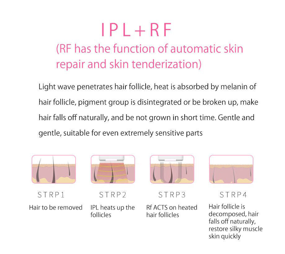 Ultrafast Ipl Laser Permanent Hair Removal Rf High Energy Hair Removal ...