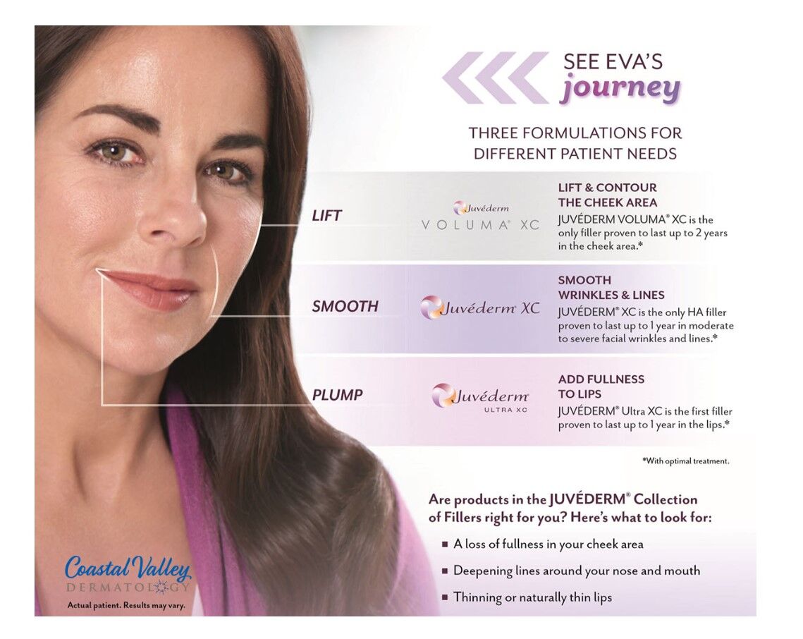 Buy Wholesale China Juvederm'''' Ultra, Ultra Plus & Voluma & Juvederm'''' at USD 60 | Global ...
