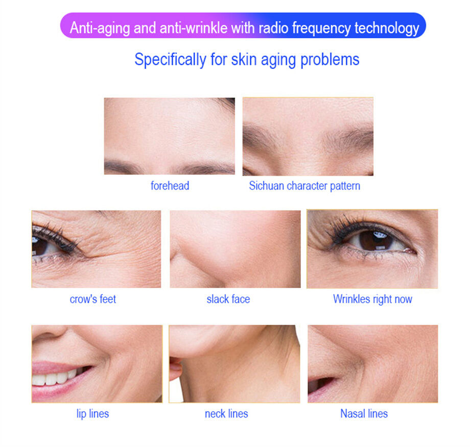 Buy Wholesale China Portable Fat Burning Exilis Ultra 360 Machine ...