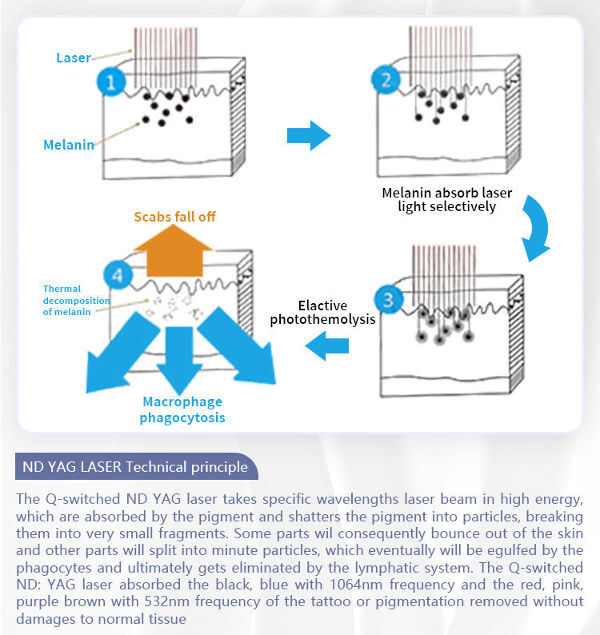 Buy Wholesale China Multifunction Lumenis M22 Aopt Machine Shr Skin ...