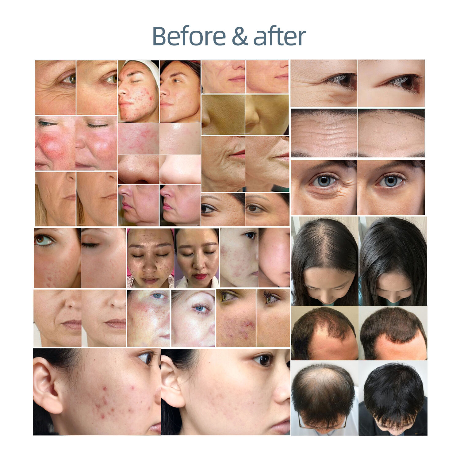 Buy Wholesale China Bowket 2024 New Derma Pen Bio Pen Q2 Micro Needling ...