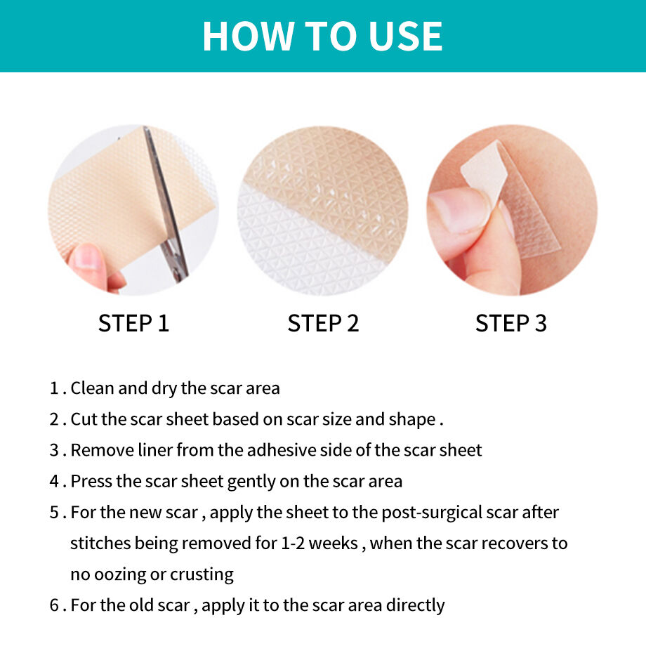 High Quality Silicone Brown Scar Strips Gel Sheets Roll Scar Tape For ...