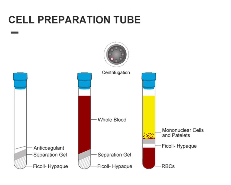Longtime 4ml Cpt Tube Mononuclear Cell Preparation Tube - Expore China ...
