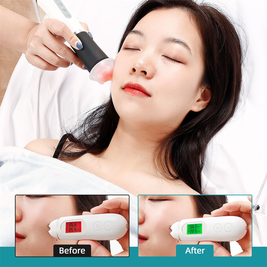 Buy China Wholesale Skin Care Pollogen Co2 Oxygenation 3 In 1 Oxygeneo ...
