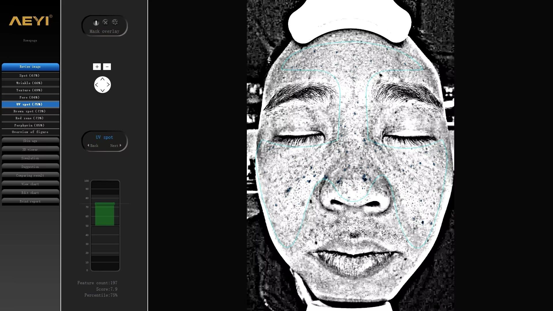 Buy China Wholesale Professional Skin Analysis Machine, Face Skin ...