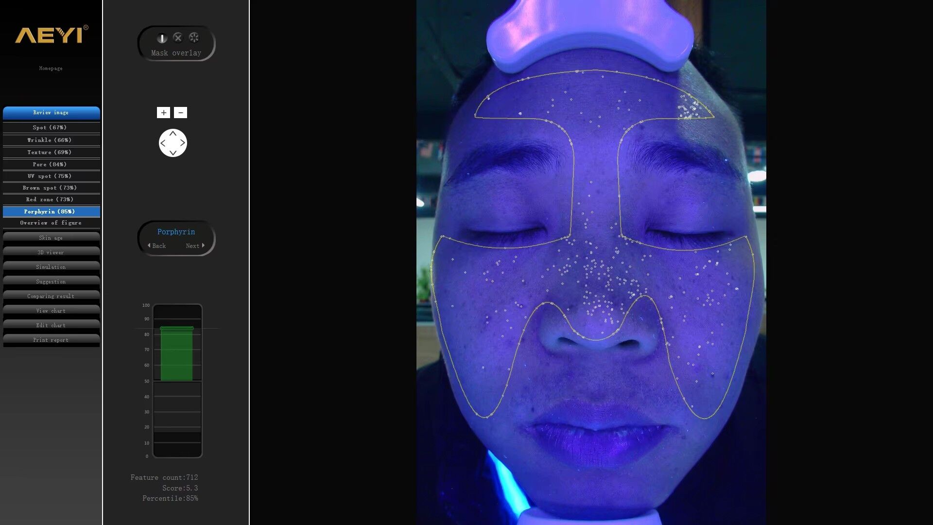 Buy China Wholesale Professional Skin Analysis Machine, Face Skin ...