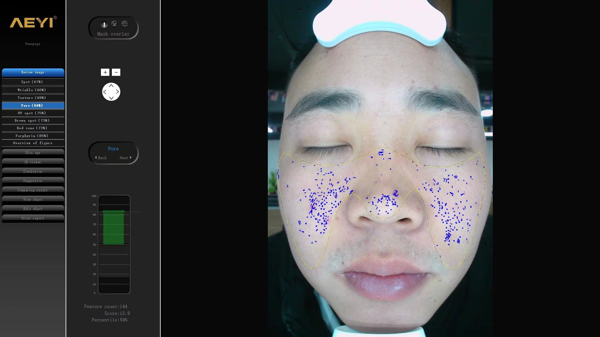 Buy China Wholesale Professional Skin Analysis Machine, Face Skin ...