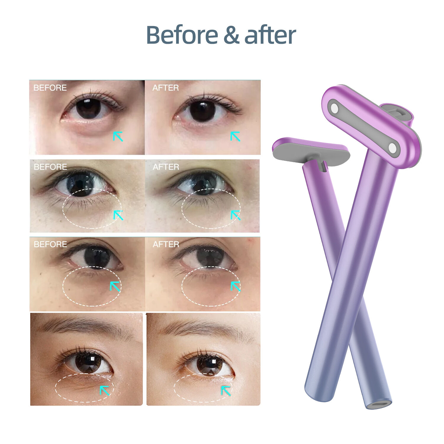 Bowket Eye Massage Equipment Eye Lifting Skin Rejuvenation $6.9 ...