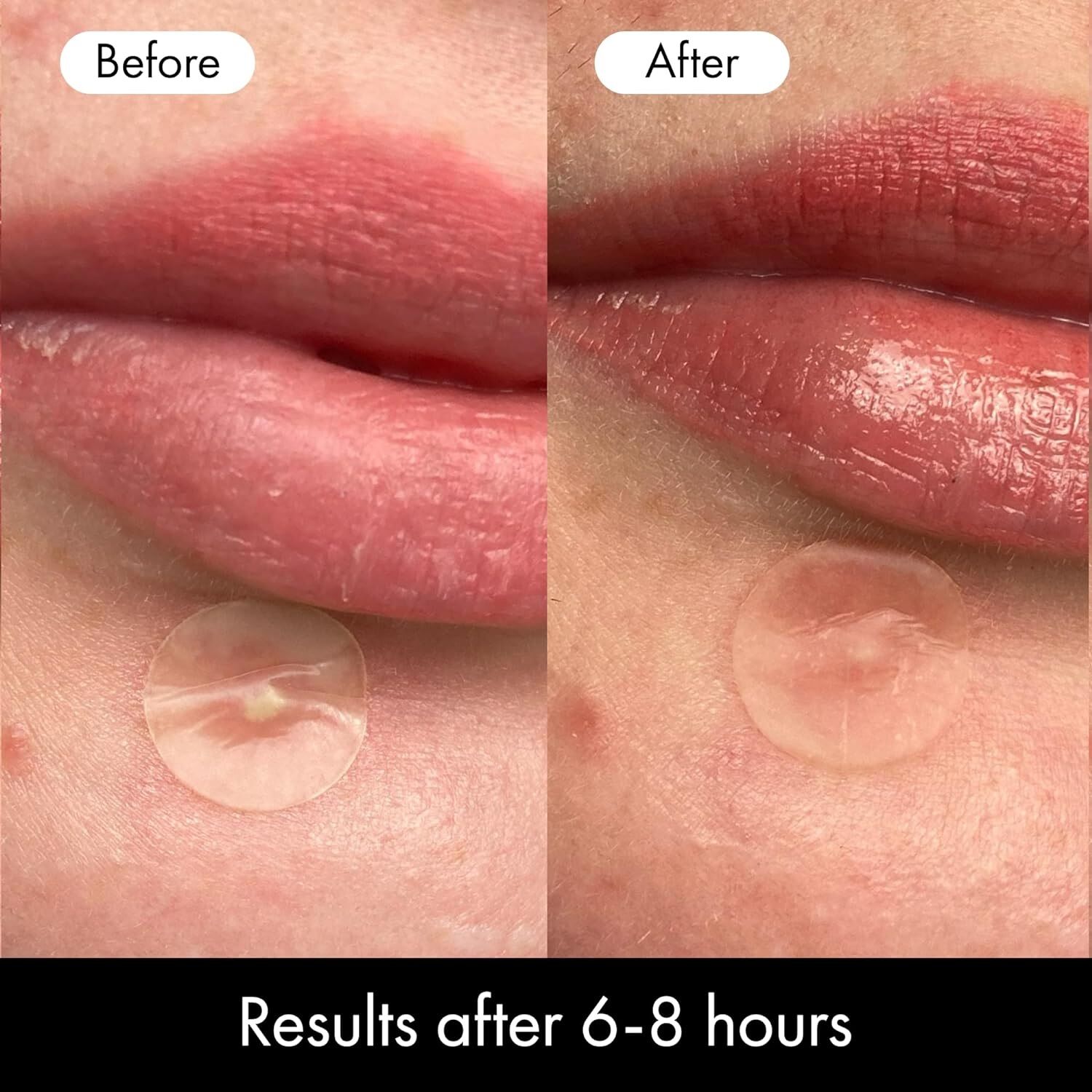 Buy United States Wholesale Hero Cosmetics Mighty Patc Original Patch ...