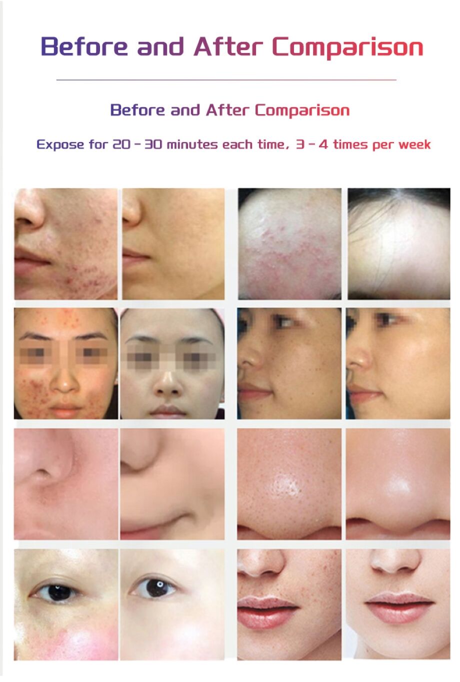 Customized Home Use Infrared Panel, Led And Abs Material Red Light ...