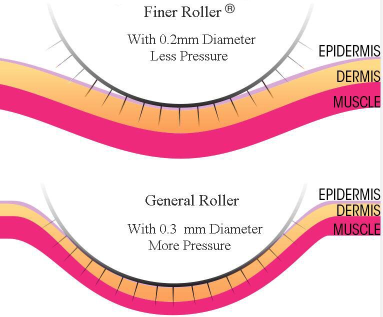 Buy China Wholesale Customized 540 Micro Needle Roller For Body Care ...