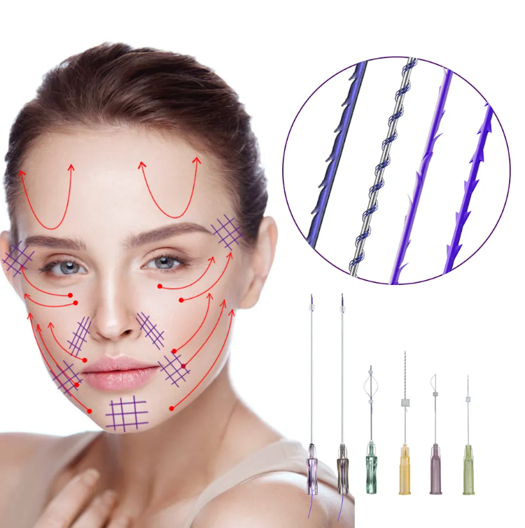 Facial Tensores 18g 100mm 120mm Cheek Jaw Line Breast Butts Lift ...